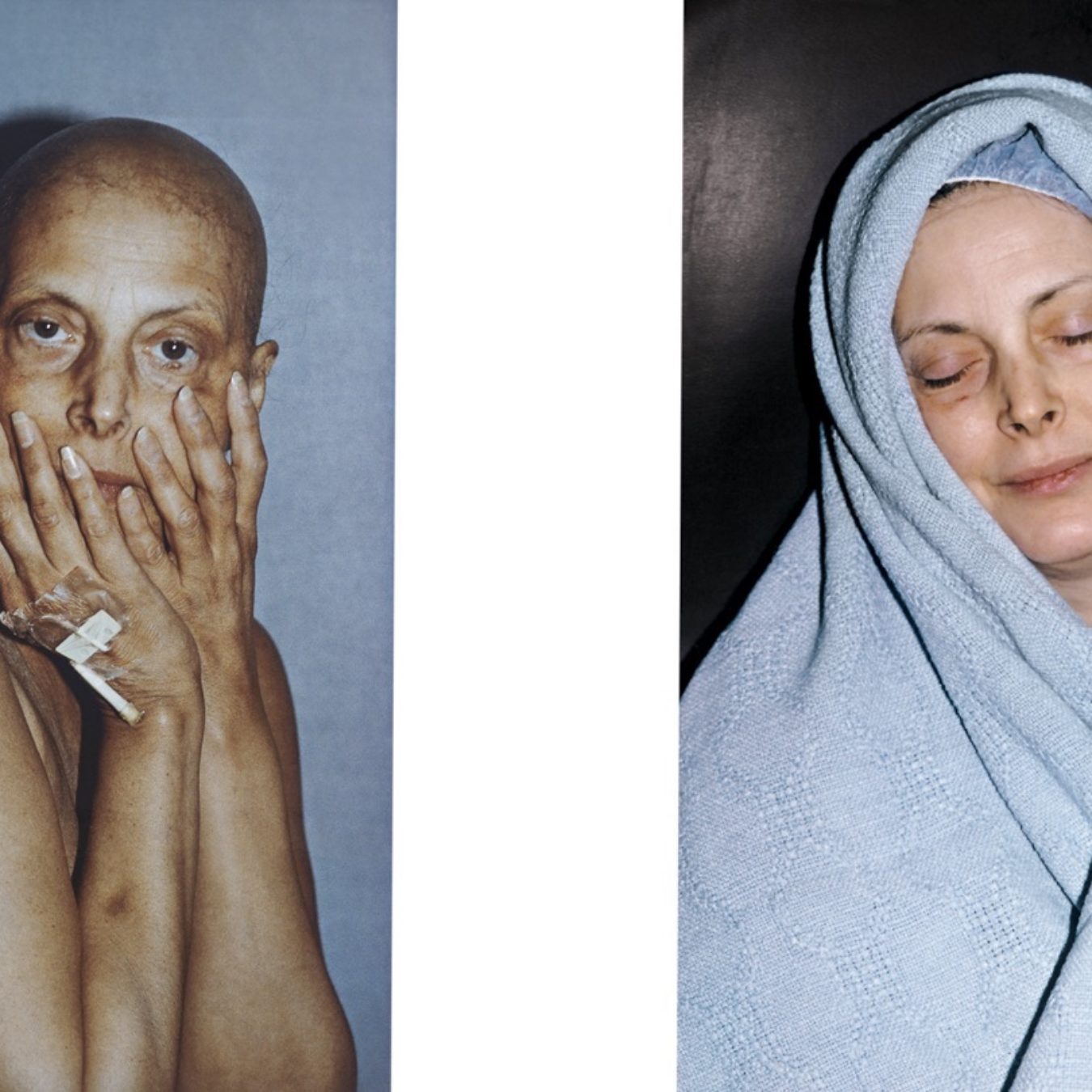 Hannah Wilke’s work remains as challenging and relevant as ever